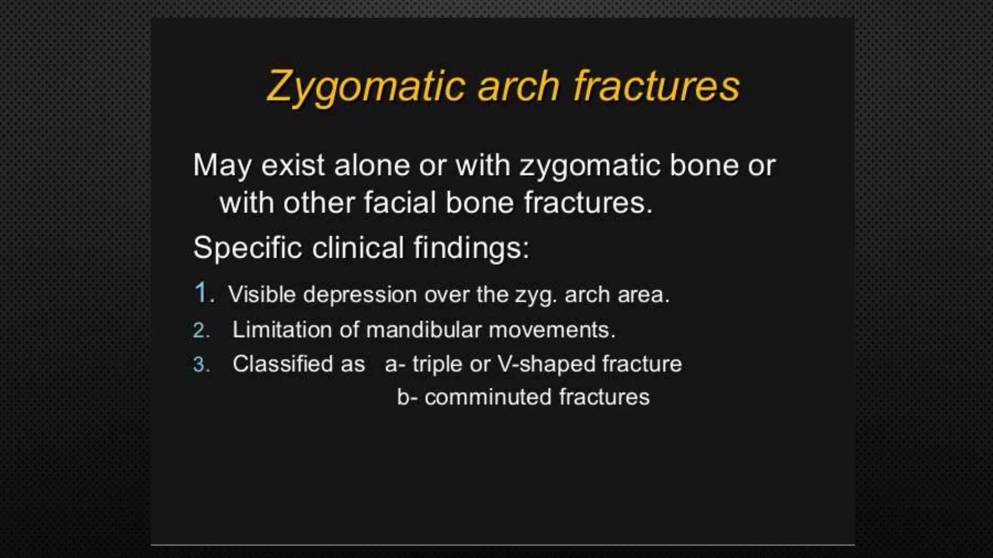 Zygomatic arch fracture | PPTX