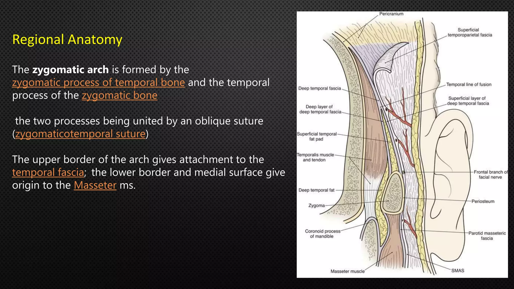 Zygomatic arch fracture | PPTX