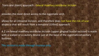Zygomatic arch fracture | PPTX