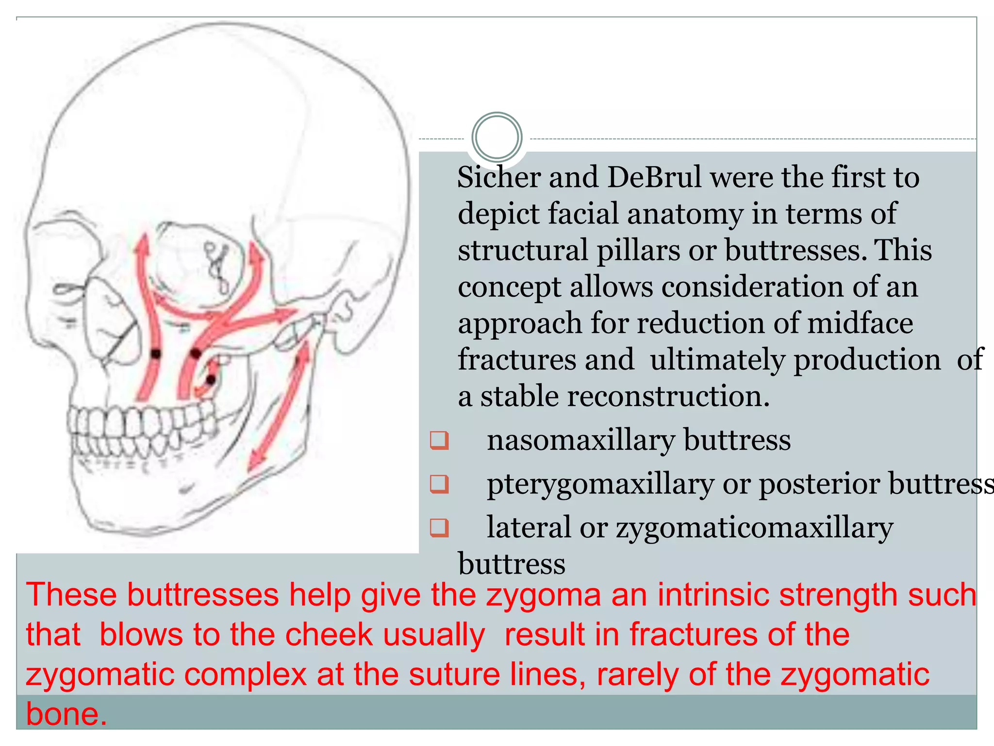 Zygomatic Complex Fracture- ZMC | PPTX