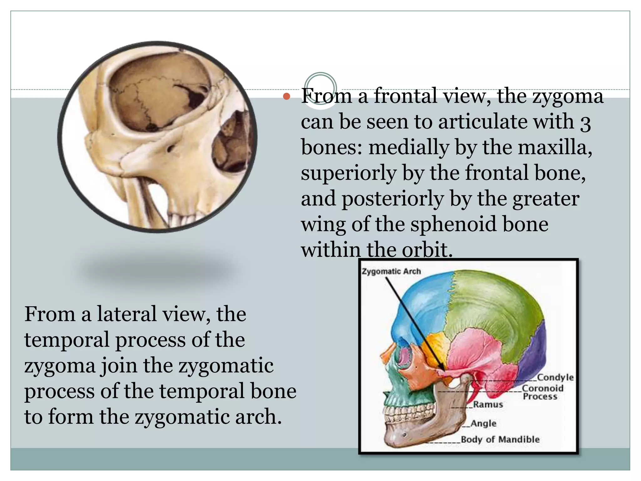 Zygomatic Complex Fracture- ZMC | PPTX
