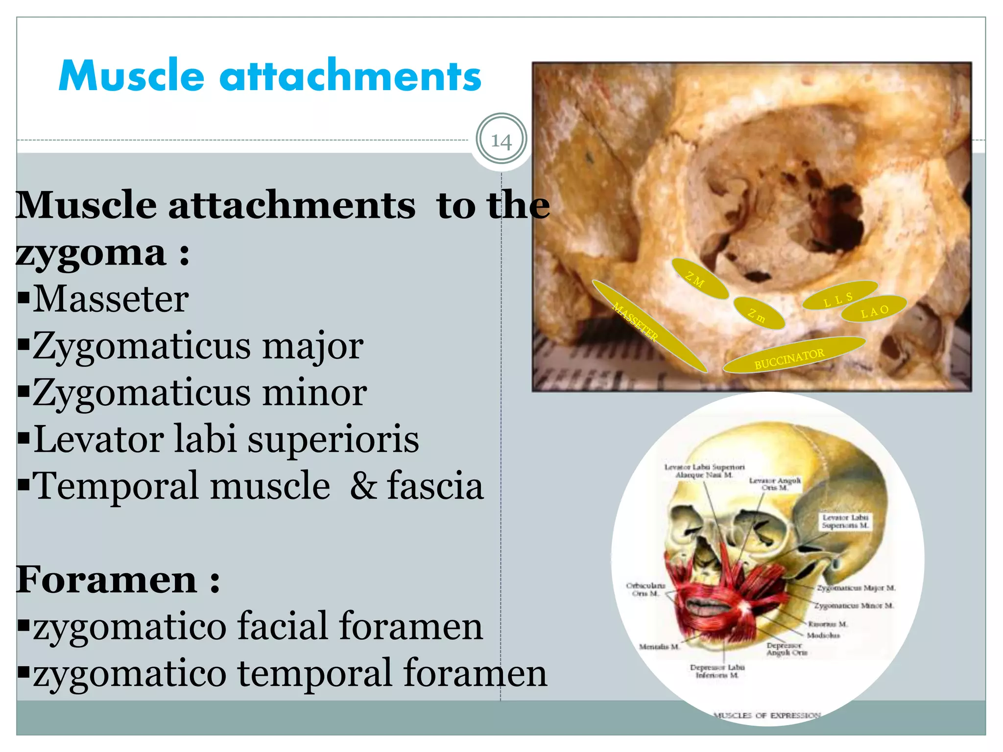 Zygomatic Complex Fracture- ZMC | PPTX