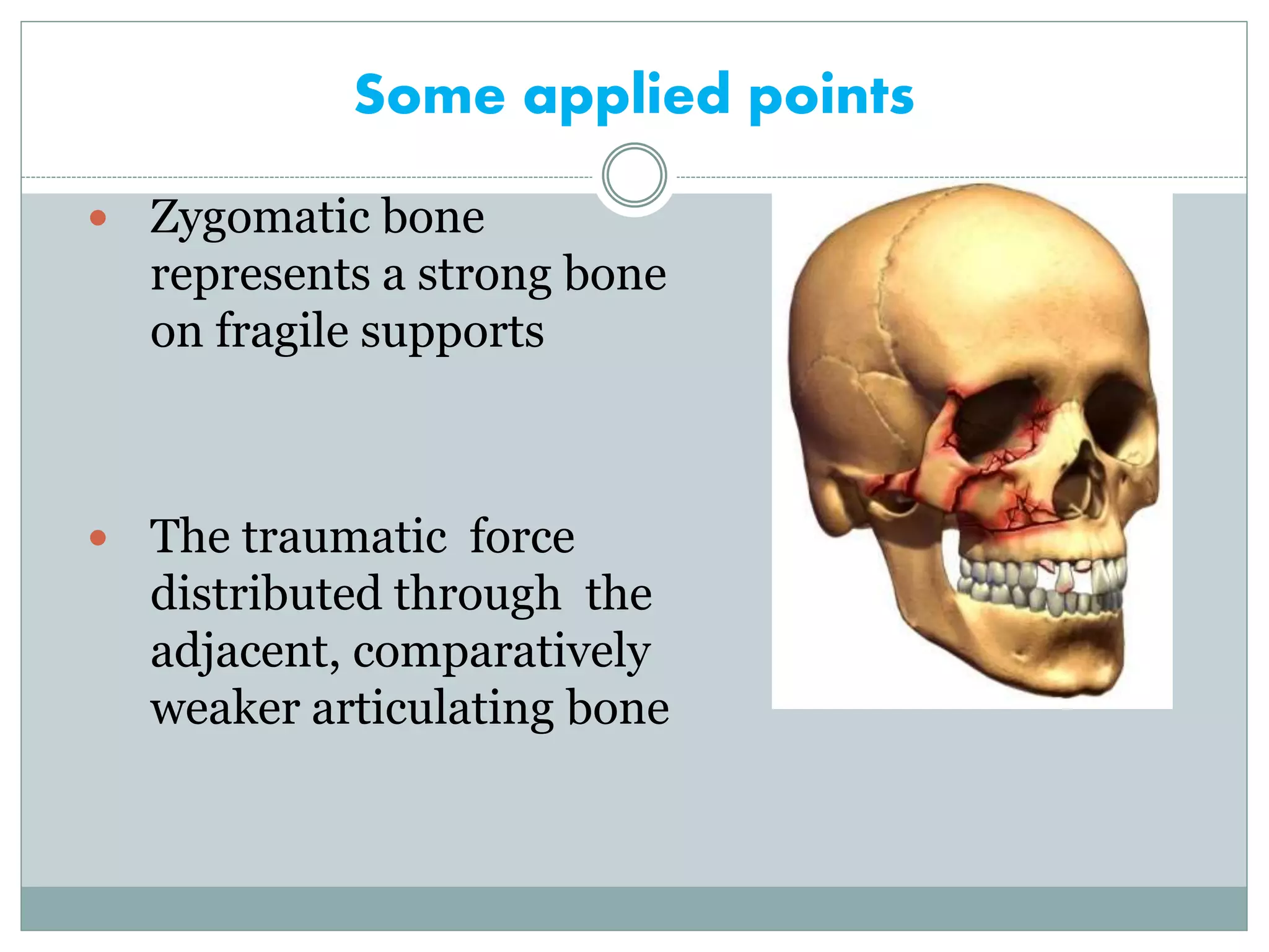 Zygomatic Complex Fracture- ZMC | PPTX