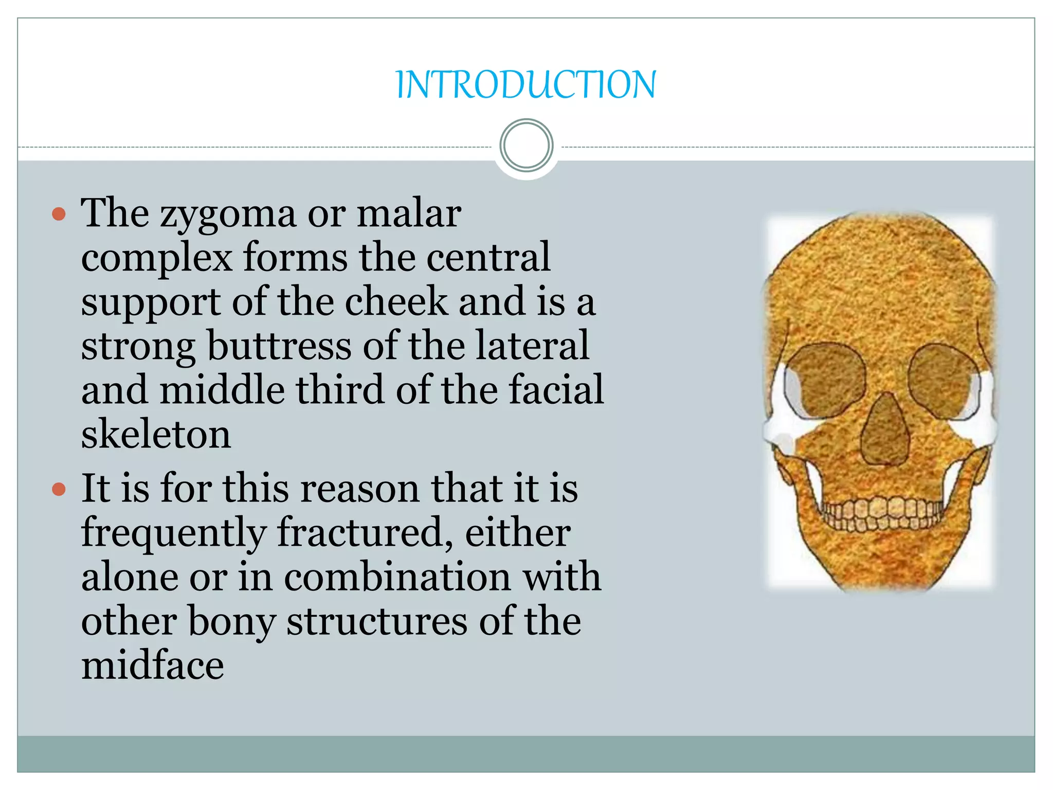 Zygomatic Complex Fracture- ZMC | PPTX