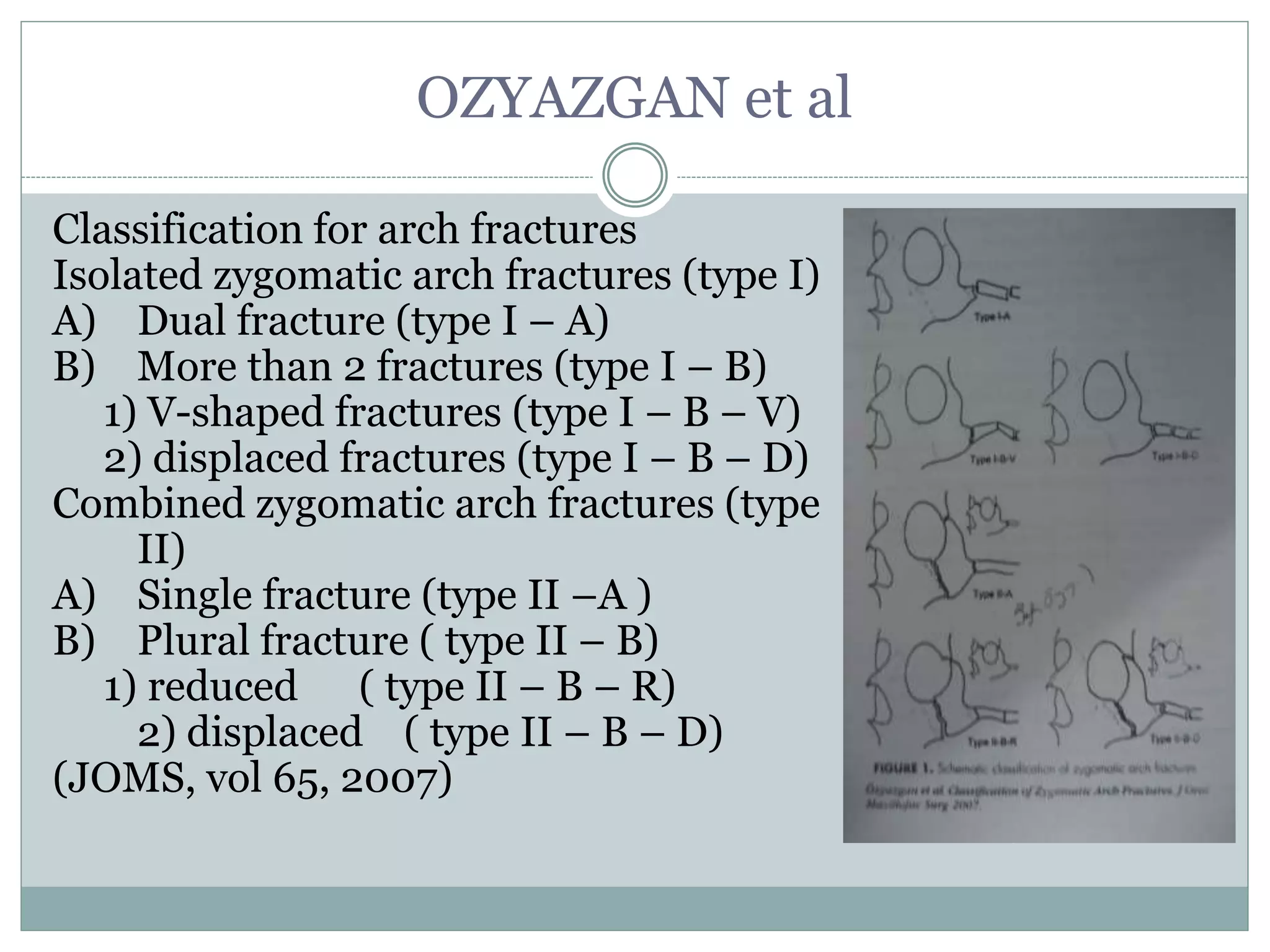 Zygomatic Complex Fracture- ZMC | PPTX