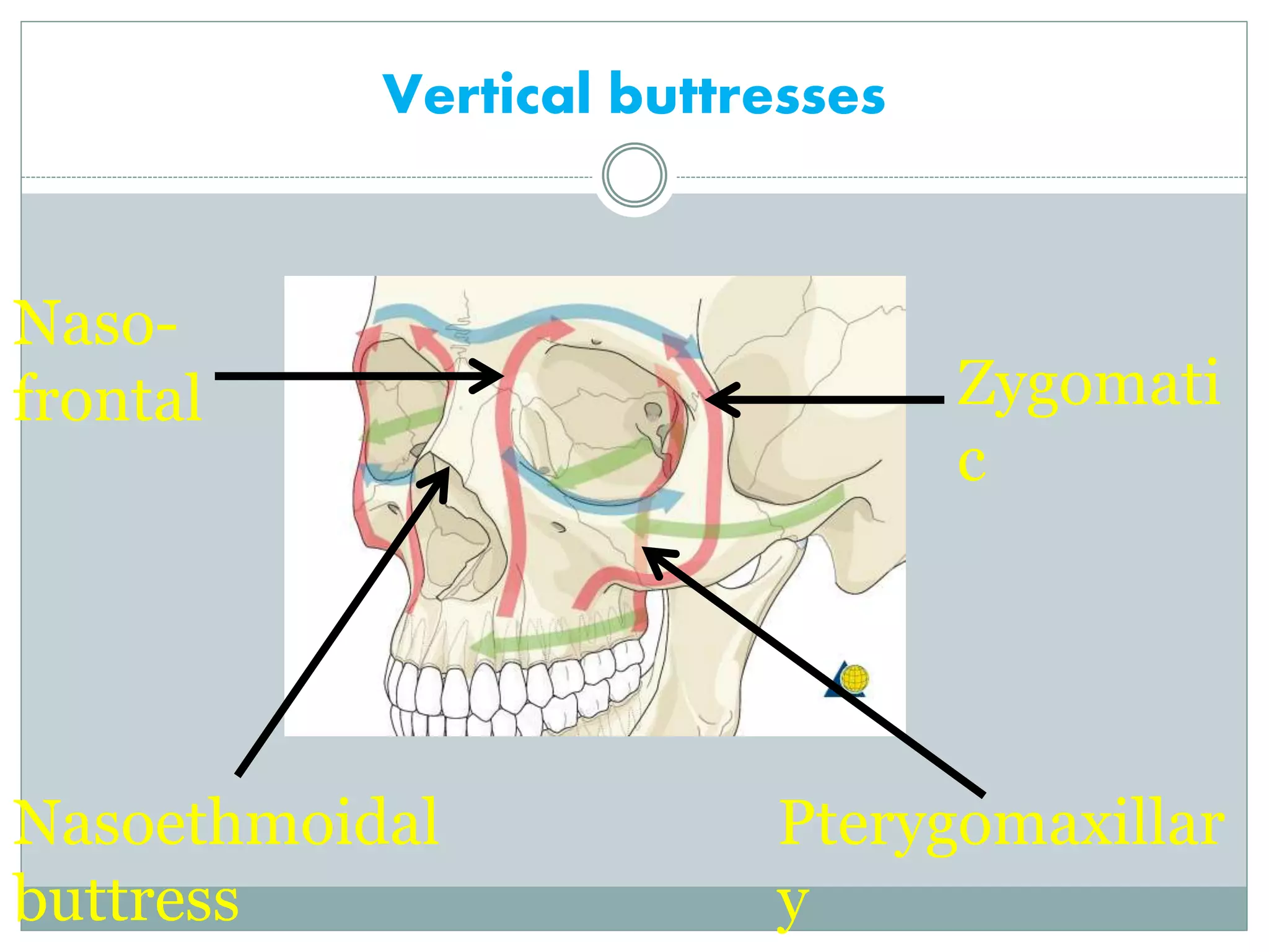 Zygomatic Complex Fracture- ZMC | PPTX