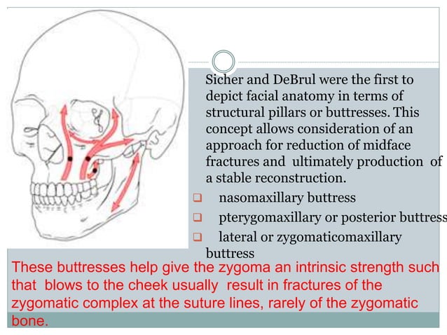 Zygomatic Complex Fracture- ZMC | PPTX | Death, Injury, or Military ...