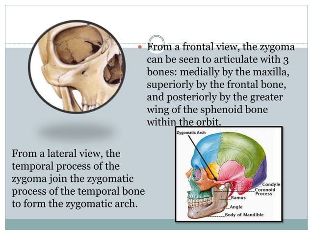 Zygomatic Complex Fracture- ZMC | PPTX | Death, Injury, or Military ...