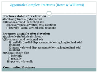 Zygomatic Complex Fracture- ZMC | PPTX