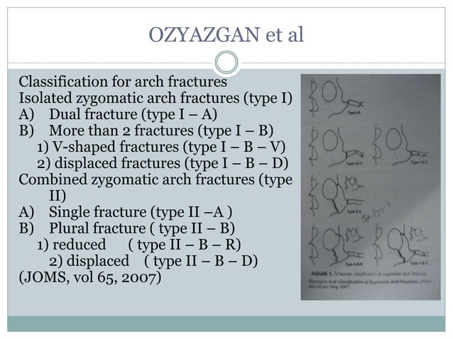 Zygomatic Complex Fracture- ZMC | PPTX | Death, Injury, or Military ...