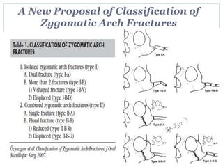 Zygomatic Complex Fracture- ZMC | PPTX