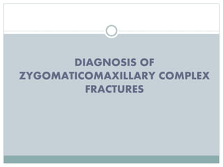 Zygomatic Complex Fracture- ZMC | PPTX