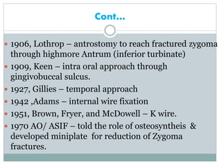 Zygomatic Complex Fracture- ZMC | PPTX