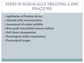 Zygomatic Complex Fracture- ZMC | PPTX