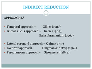 Zygomatic Complex Fracture- ZMC | PPTX