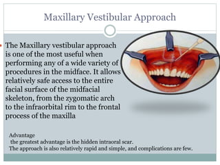 Zygomatic Complex Fracture- ZMC | PPTX