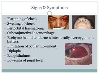 Zygomatic Complex Fracture- ZMC | PPTX | Death, Injury, or Military ...