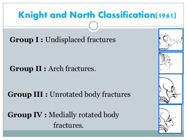 Zygomatic Complex Fracture- ZMC