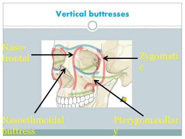 Zygomatic Complex Fracture- ZMC