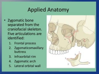 Zygomatic complex fracture | PPT