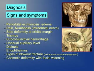 Zygomatic complex fracture | PPT