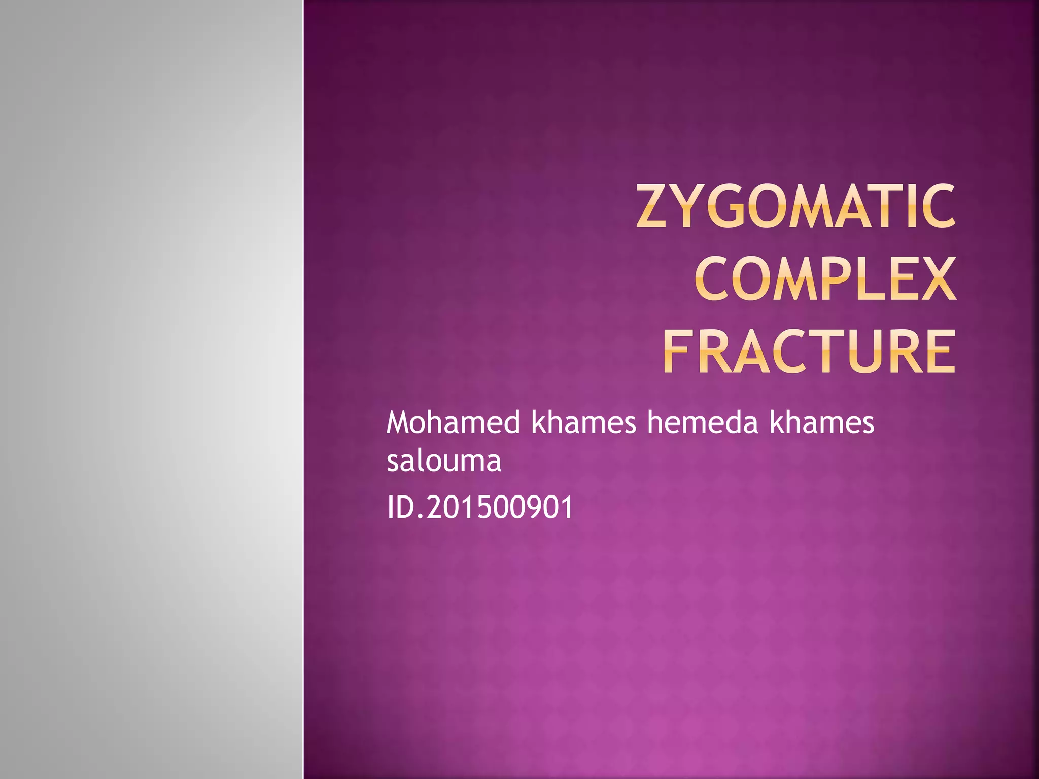 Zygomatic complex fracture | PPTX