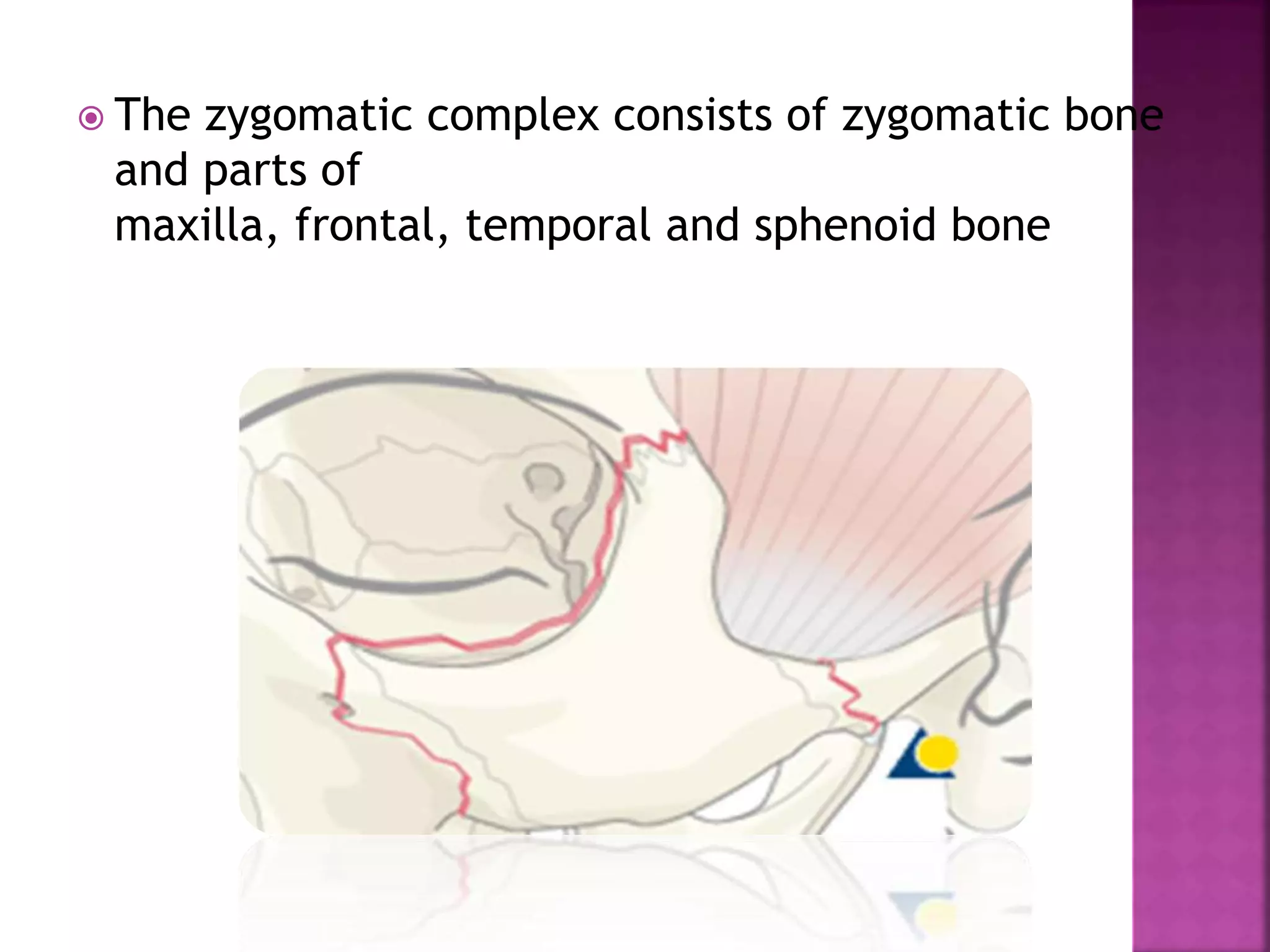 Zygomatic complex fracture | PPTX