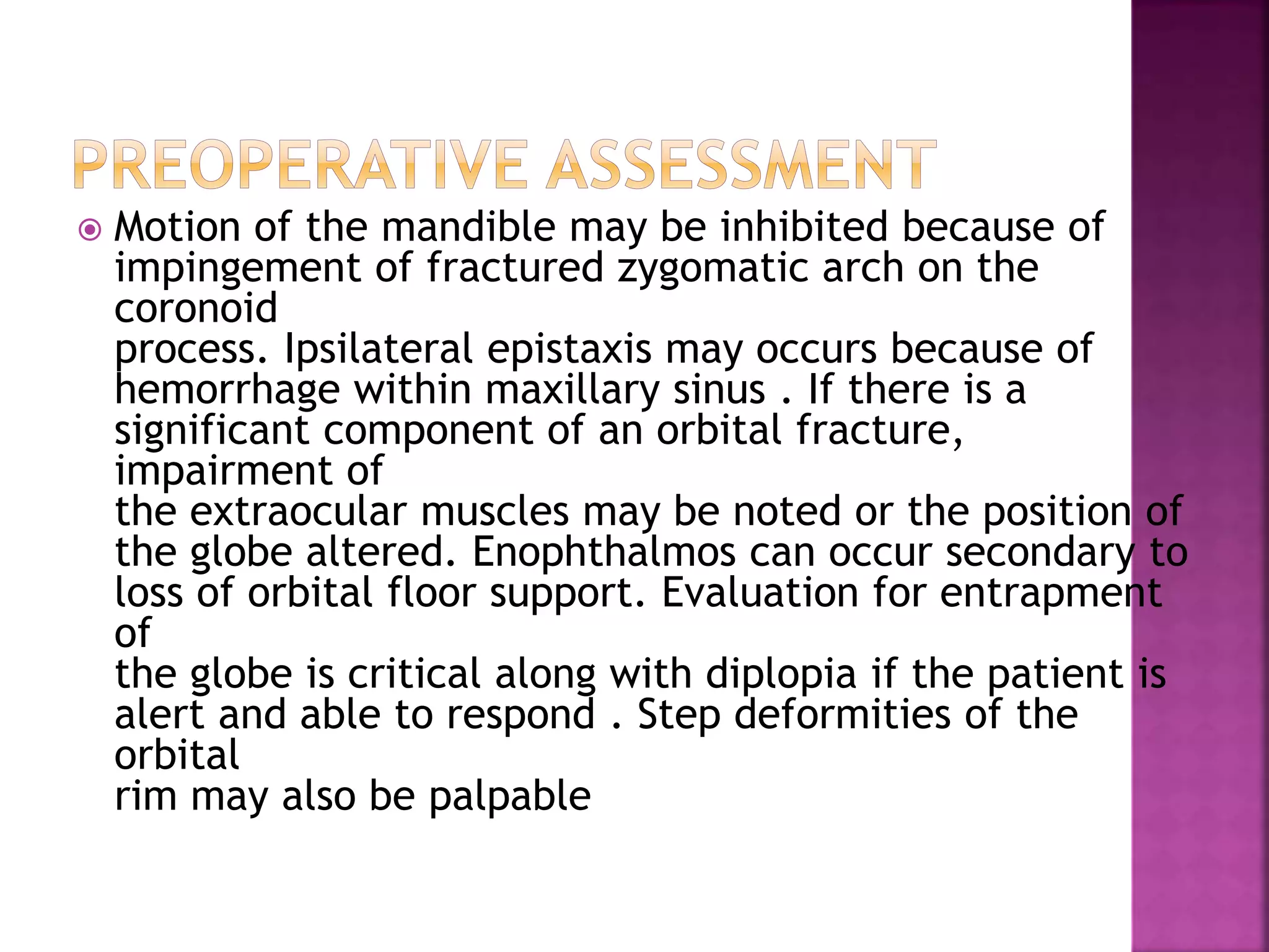 Zygomatic complex fracture | PPTX