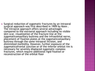 Zygomatic complex fracture | PPTX