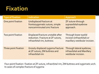 Zygomatic complex fractures | PPTX