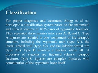 Zygomatic complex fractures | PPTX