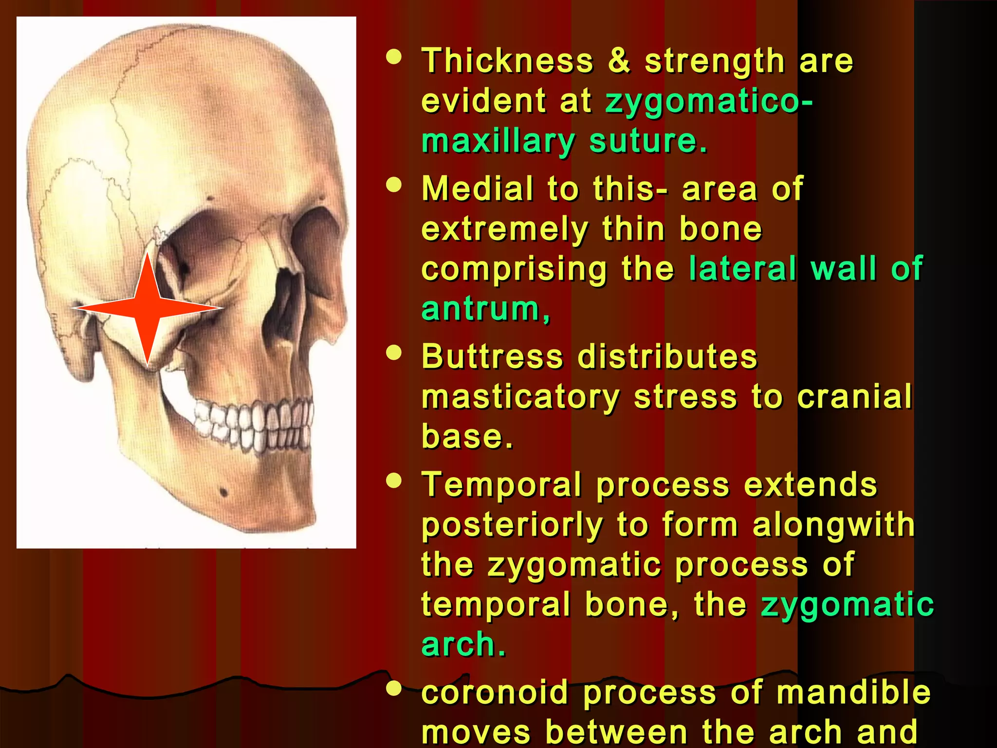 Zygomatic complex fractures ih | PPT | Death, Injury, or Military Conflict | Sensitive Topics