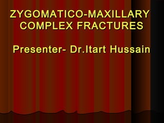 Zygomatic complex fractures ih | PPT