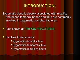 Zygomatic complex fractures ih | PPT