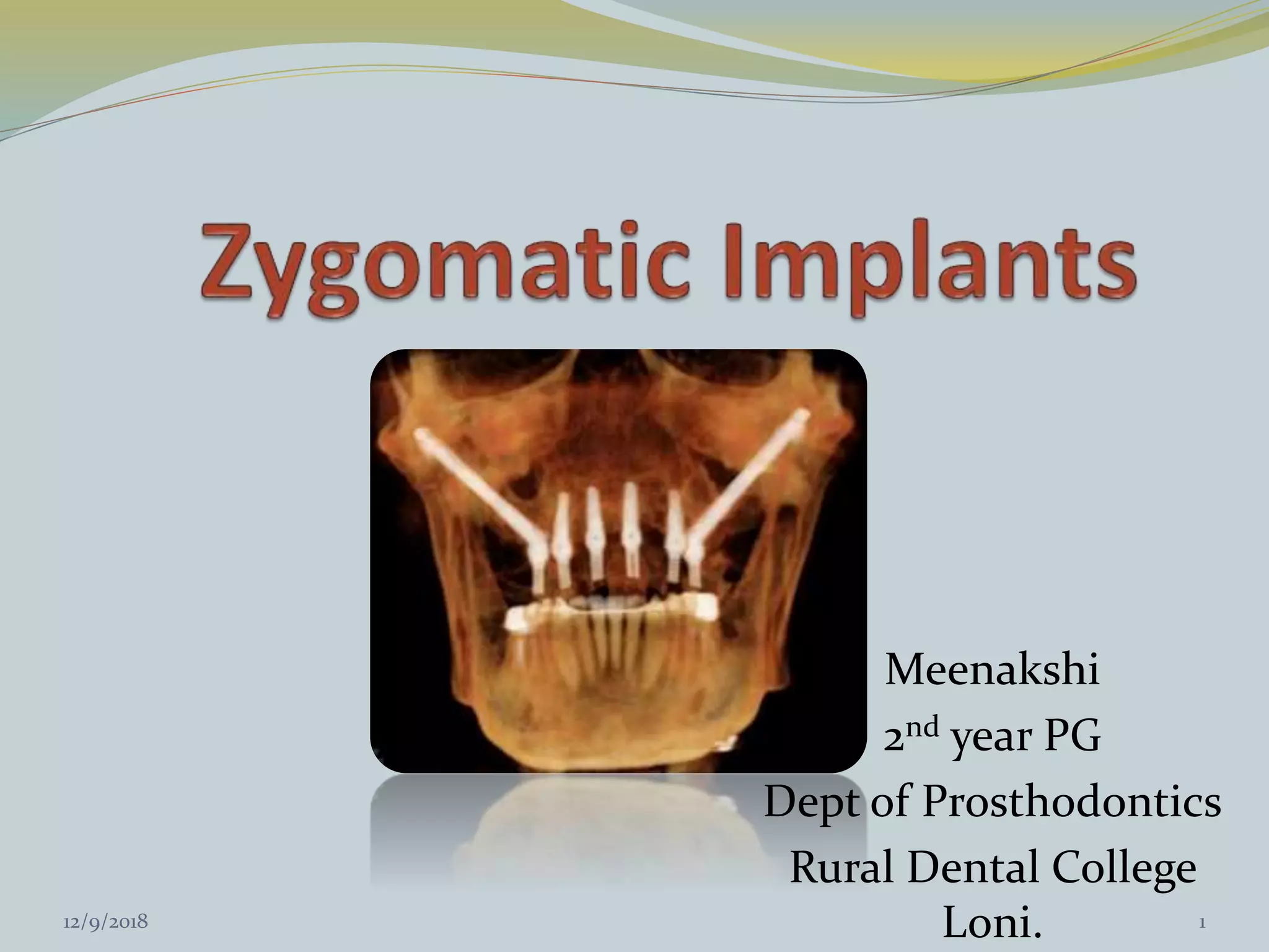 Zygomatic implants | PPTX