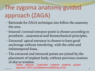 Zygomatic implants | PPTX