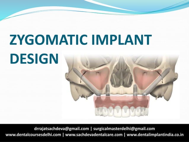 Zygomatic implants | PPTX | Bone and Joint Conditions | Diseases and ...