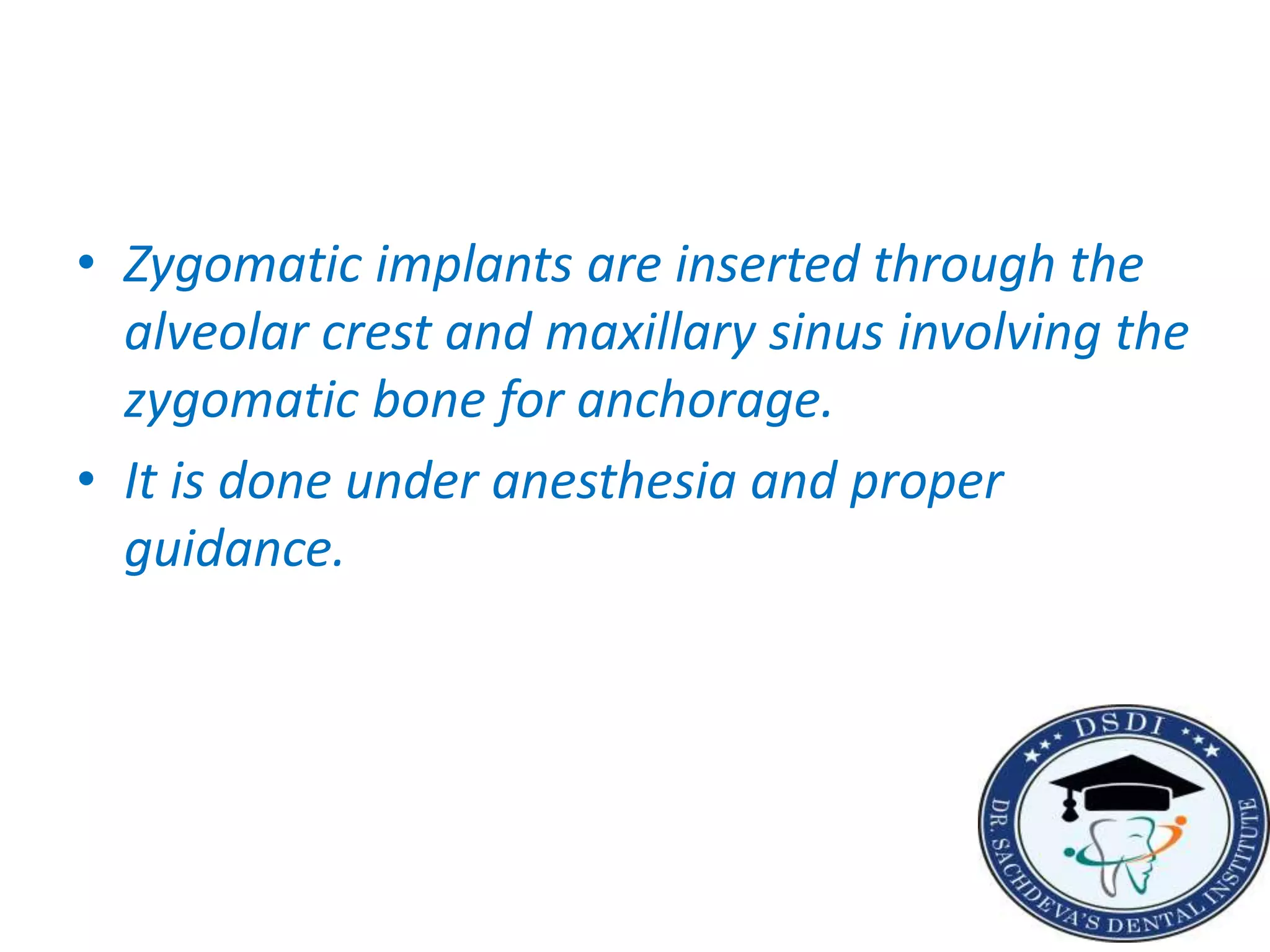 Zygomatic iImplants |Ashok Vihar | Delhi | PPTX
