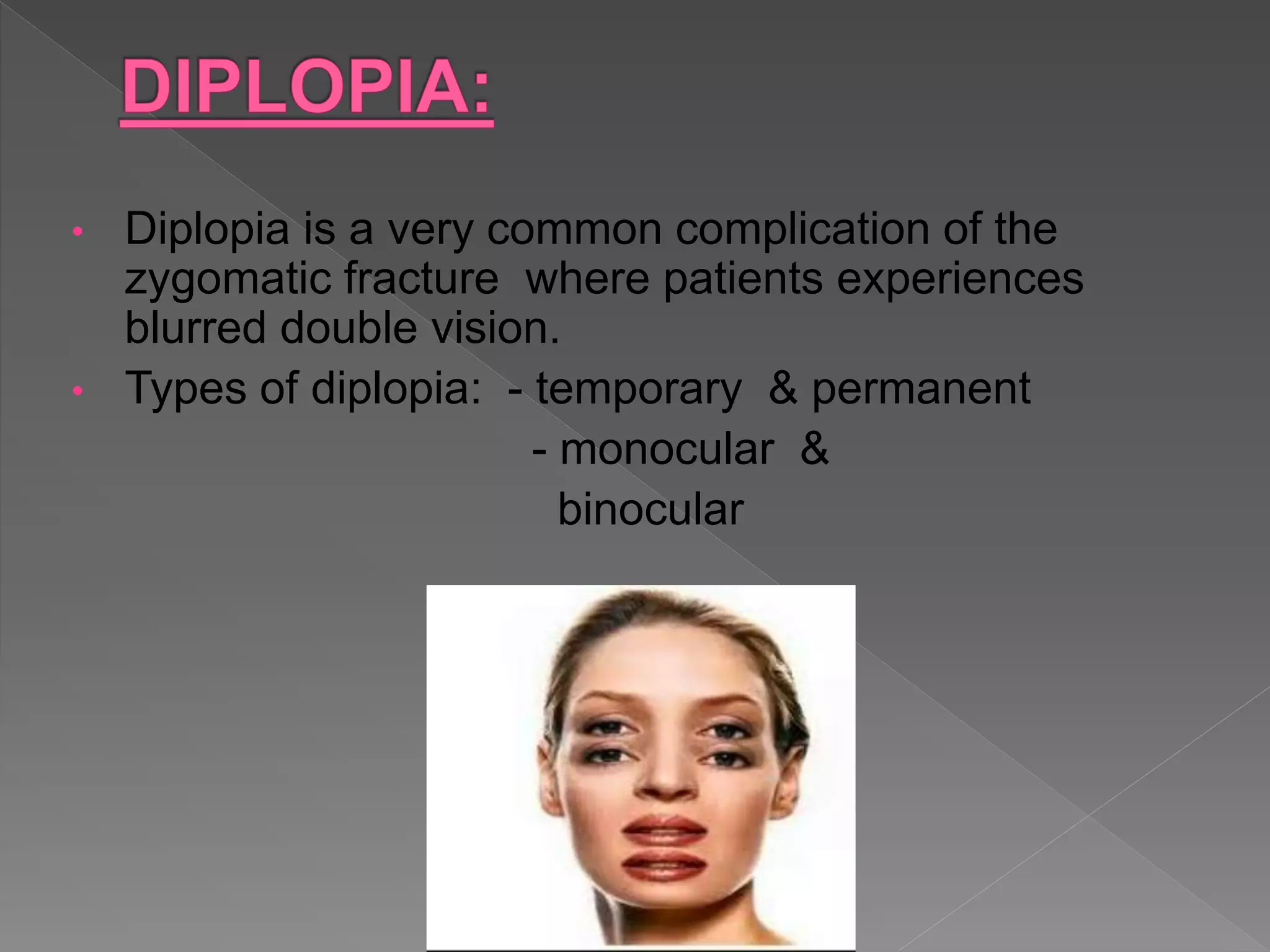 ZYGOMATICO MAXILLARY COMPLEX FRACTURE | PPTX