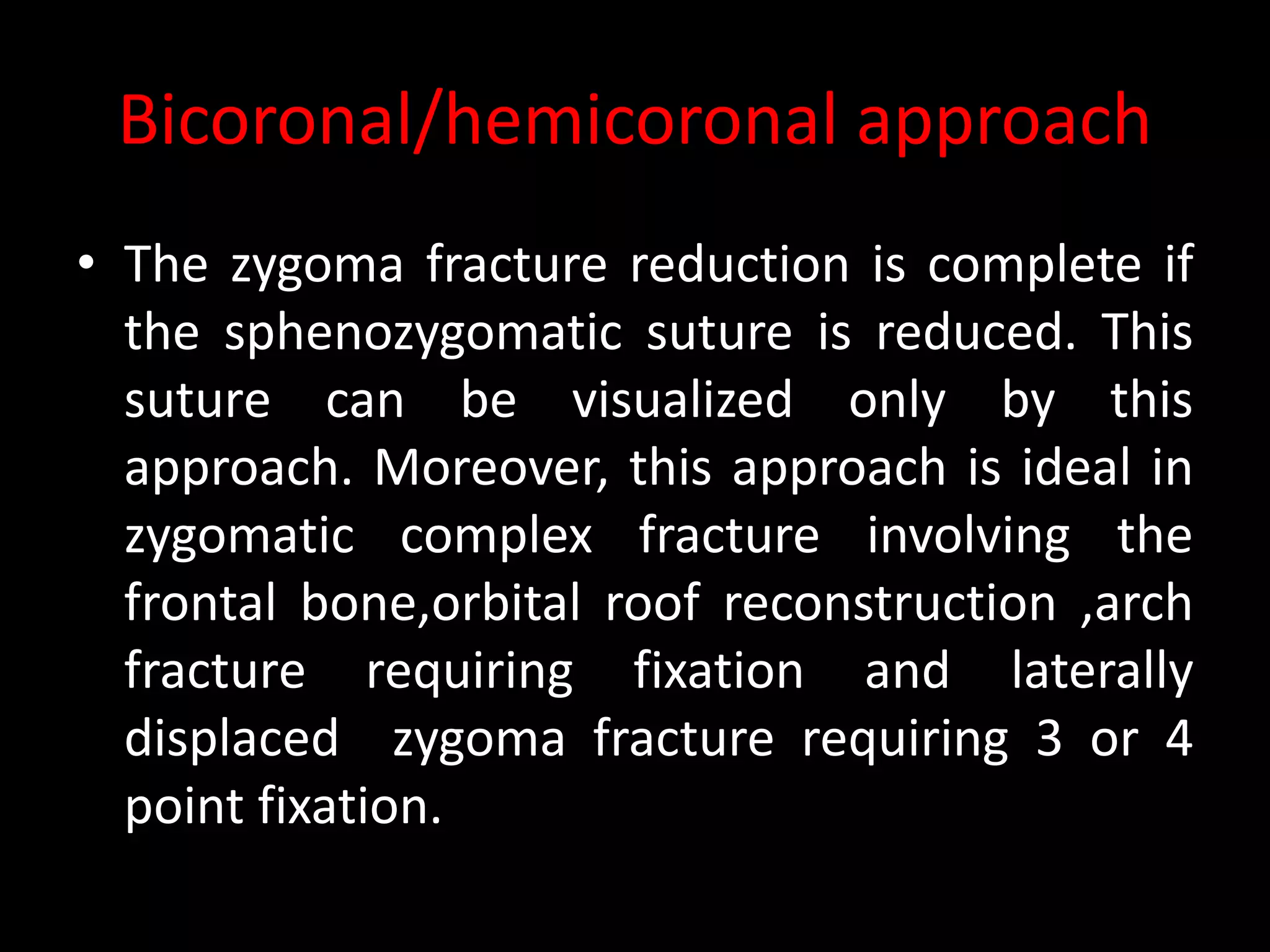 Zygomatic maxillary complex fracture | PPTX