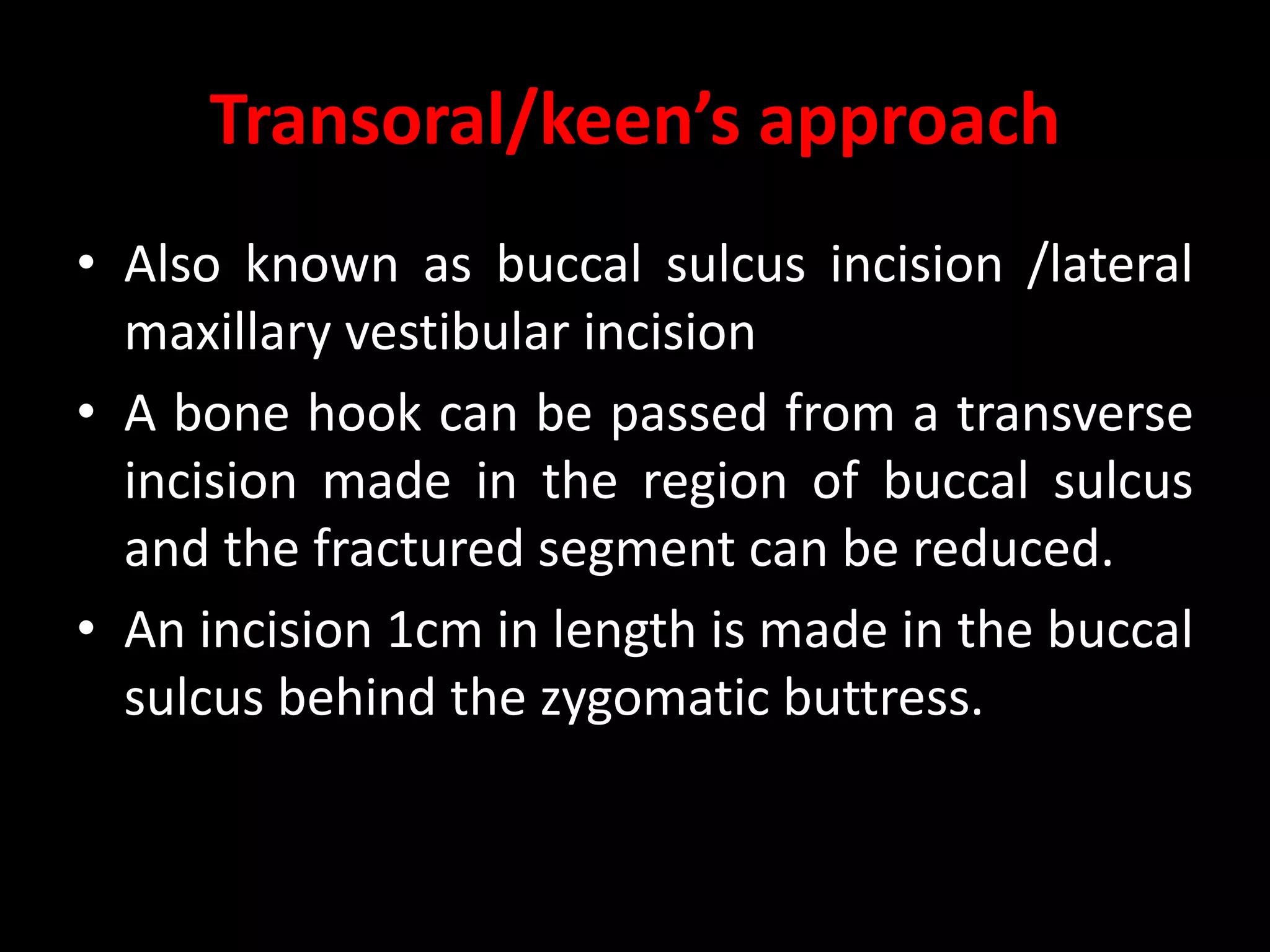 Zygomatic maxillary complex fracture | PPTX