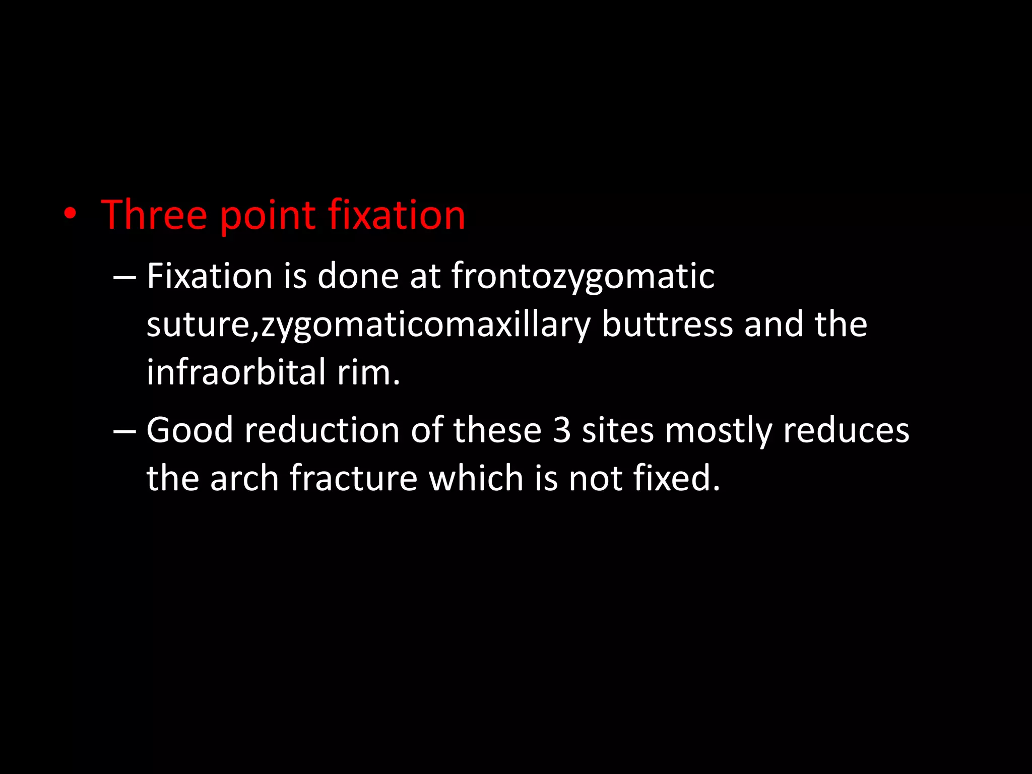 Zygomatic maxillary complex fracture | PPTX