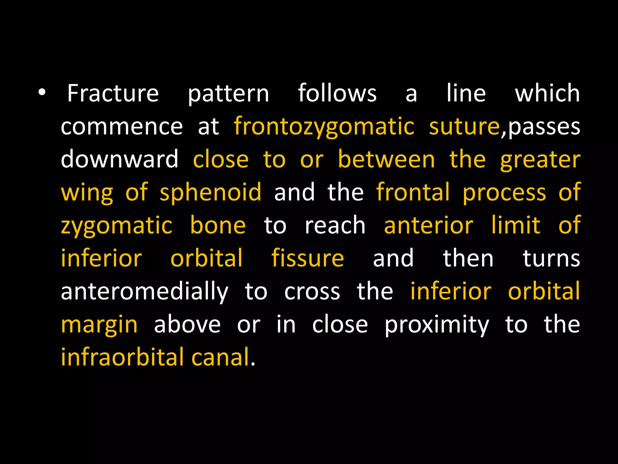 Zygomatic maxillary complex fracture | PPTX