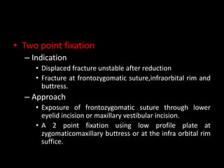 Zygomatic maxillary complex fracture | PPTX