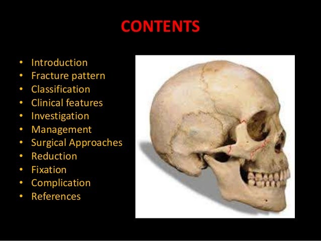 Zygomatic Maxillary Complex Fracture