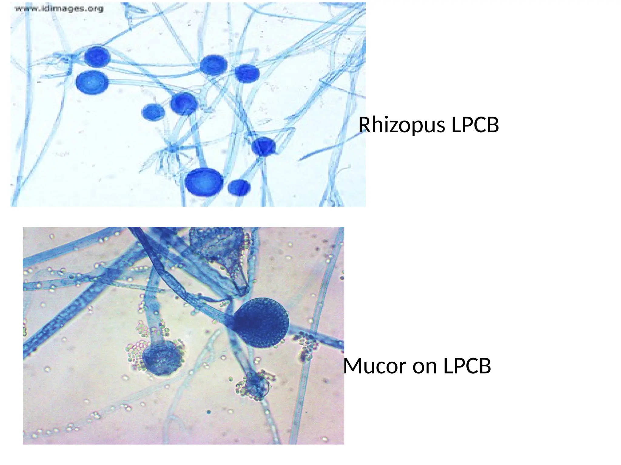 zygomycosis aboutfull data.pptx thats it | PPTX