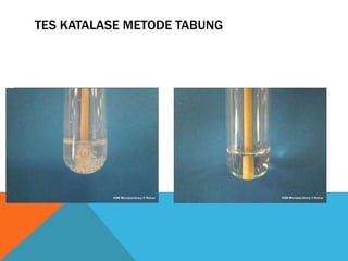 bakteri pada kulit dan jaringan tubuh .pptx