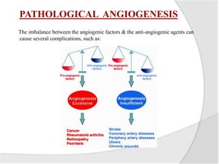 Angiogenesis and its approach to treat Cancer | PPT