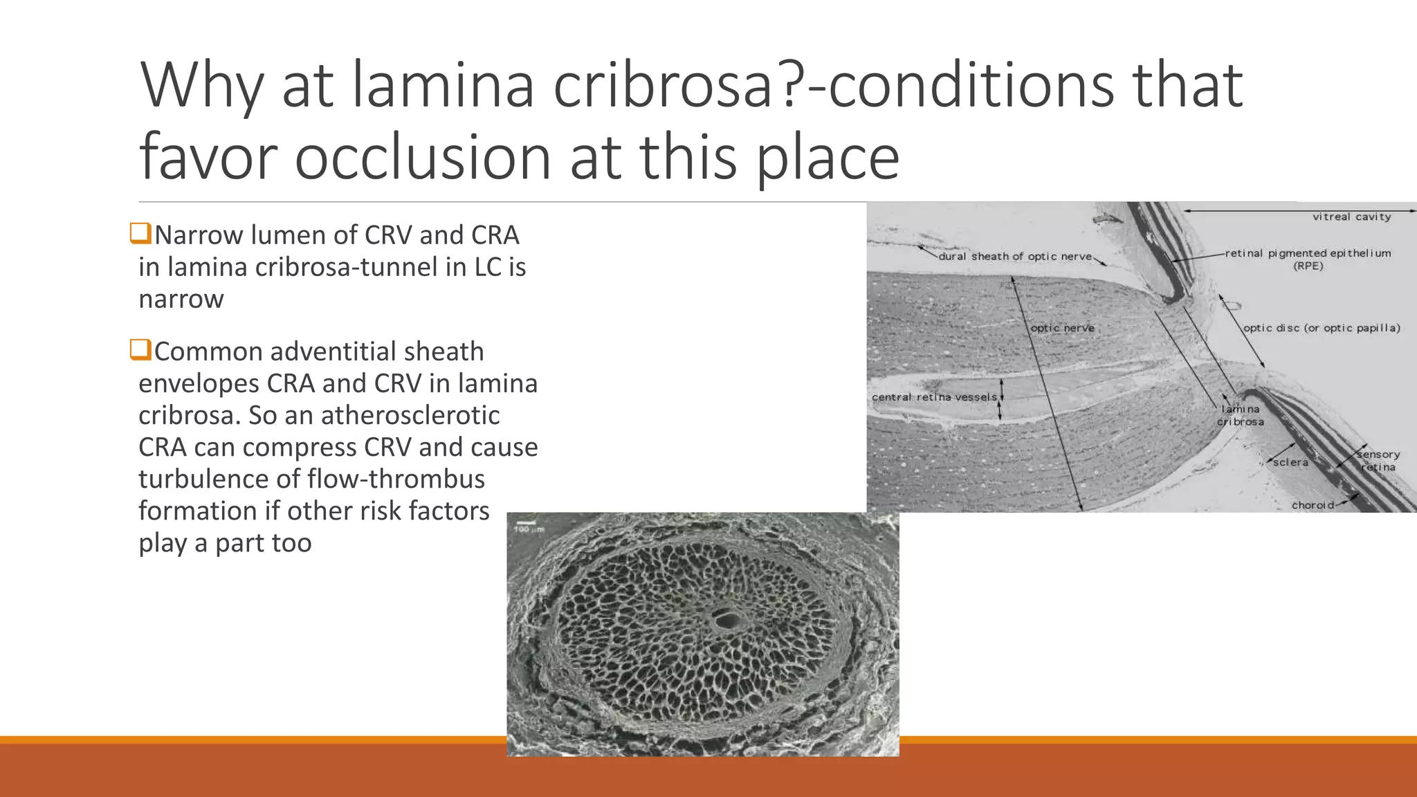 zzzCENTRAL RETINAL VEIN OCCLUSION.pptx