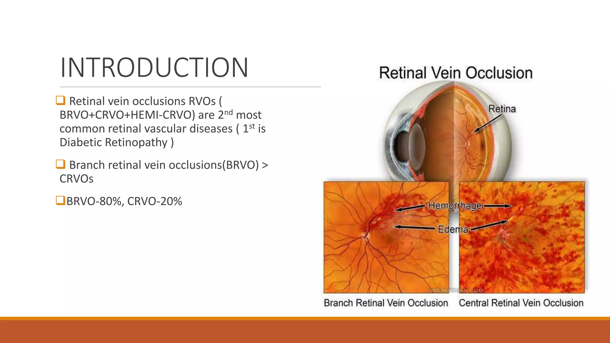 zzzCENTRAL RETINAL VEIN OCCLUSION.pptx